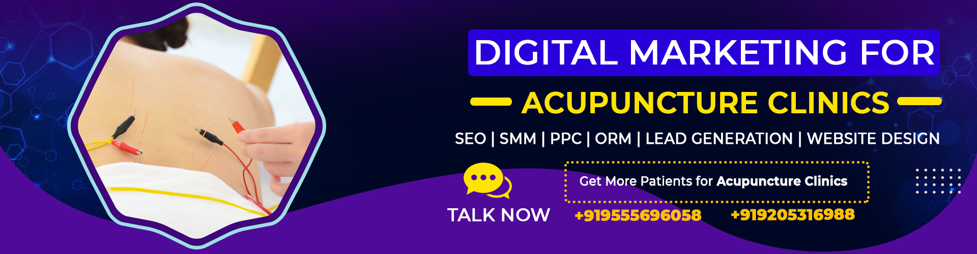Digital Marketing for Acupuncture Clinics,SEO,Social Media,PPC