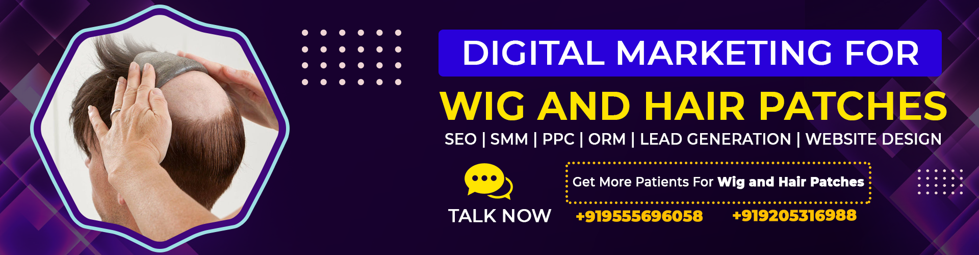 Digital Marketing for Wig and Hair Patches,SEO,Social Media,PPC